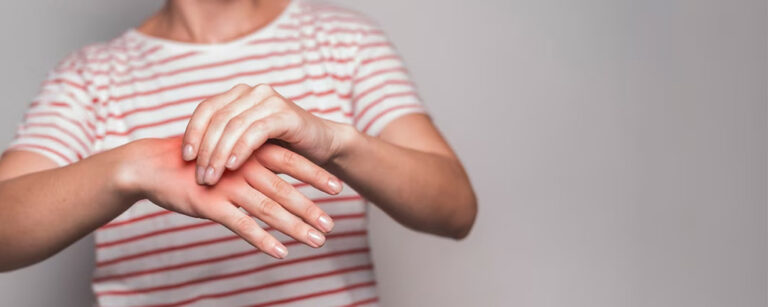 Maculopapular Rash: Causes, Appearance, and Treatment