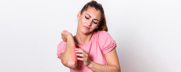 Eczema vs. Scabies: How to Tell These Common Skin Conditions Apart