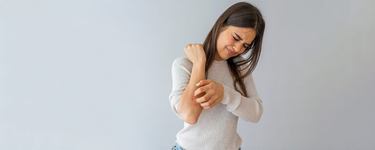 Prurigo Nodularis Pictures, Signs, Causes & Management of PN