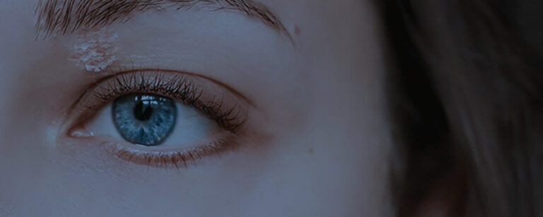 Eyelid Psoriasis: Know the Causes, Risk Factors, and Management