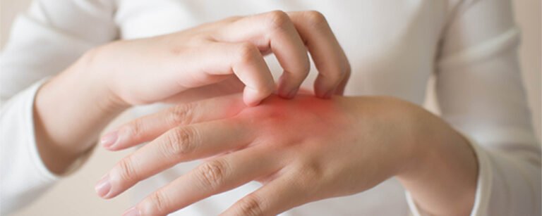 Causes of Itchy Fingers and Effective Treatments Options