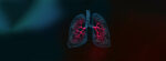 Is COPD Contagious? Diagnosis, Risk, Treatment and More!